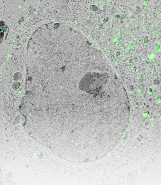 FAST-EM | Ultra-fast automated multibeam electron microscope